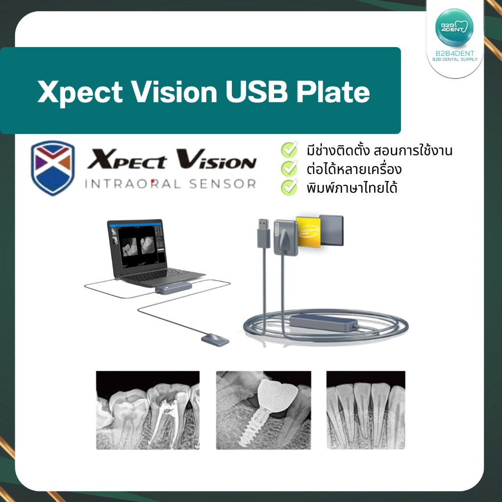 Xpect vision USB plate handy Digital x-ray plate เครื่องเอ็กซเรย์ ...