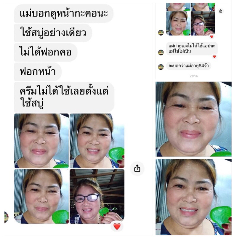 JENNESSI สบู่ใบชารักษาสิว organic100% อุดตัน อักเสบ ฝ้า กระ ผิวเเพ้ง่าย ...