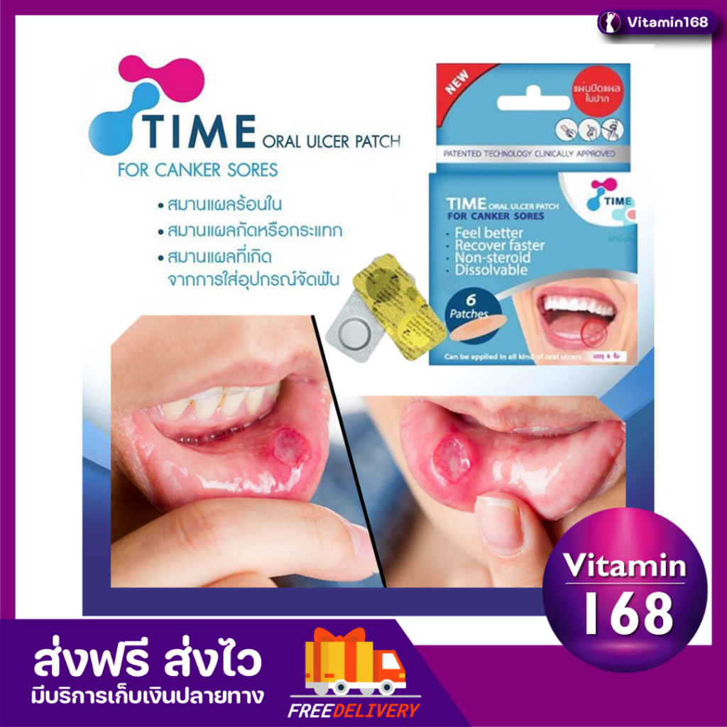 TIME Oral Ulcer Patch แผ่นปิดแผลในปาก แผลร้อนใน | Shopee Thailand
