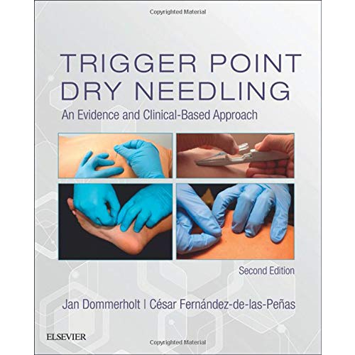 หนังสือ Trigger Point Dry Needling ตำรา กายภาพบำบัด physiotherapy แพทย์ ...