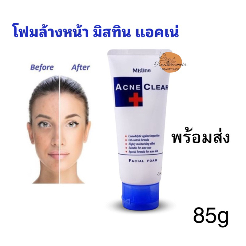 Mistine Acne Clear โฟมล้างหน้า มิสทิน แอคเน่ เคลียร์ เฟเชี่ยล โฟม 85g | Shopee Thailand