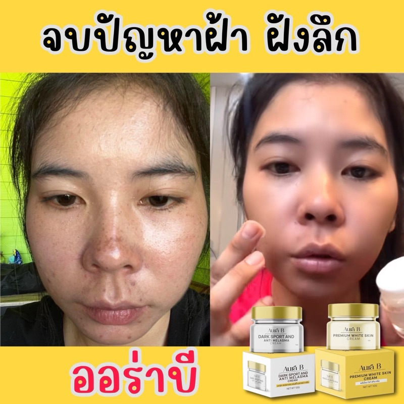Aura B (ออร่าบีพี่โบว์) ของแท้100%กดสั่งในไลฟ์50%(ส่งฟรี) | Shopee Thailand
