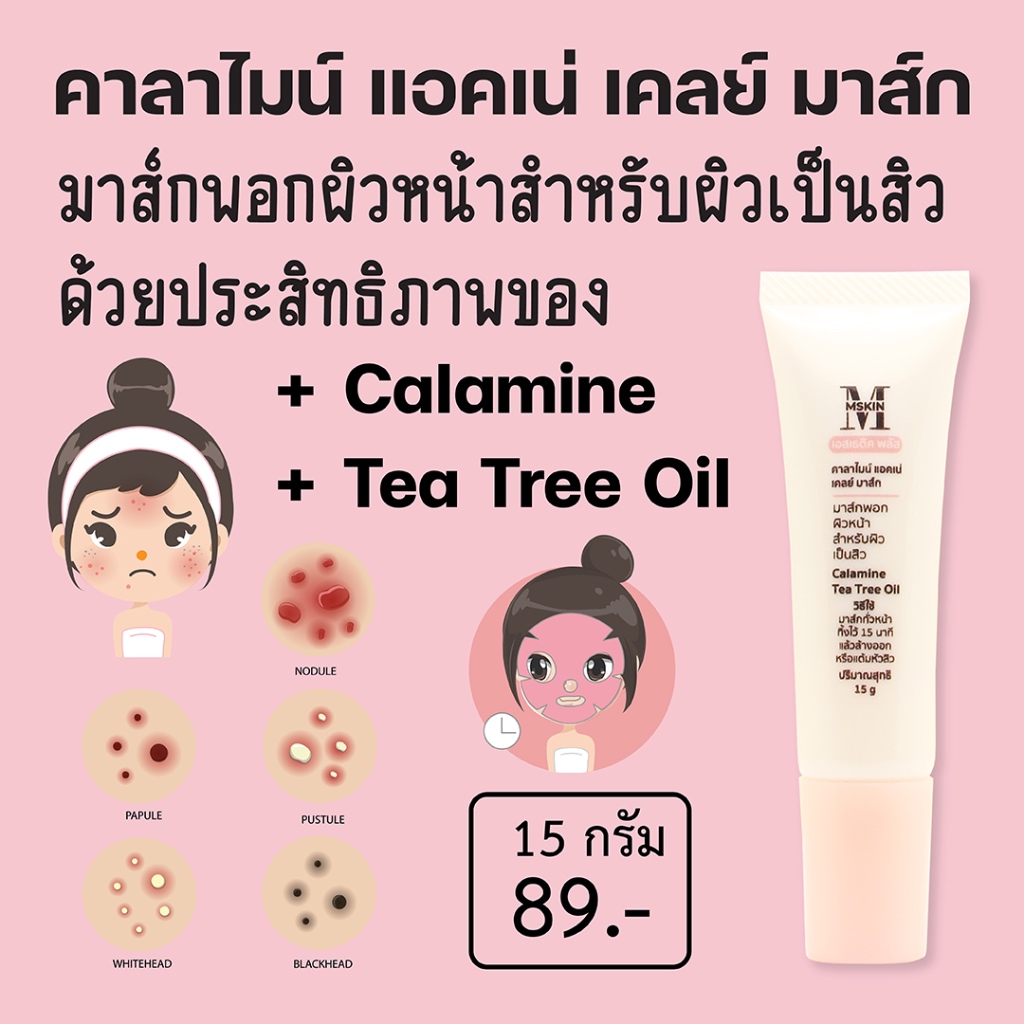 คาลาไมน์ แอคเน่ เคลย์ มาส์กโคลนสำหรับผิวเป็นสิว ให้สิวยุบตัวเร็วขึ้น ...