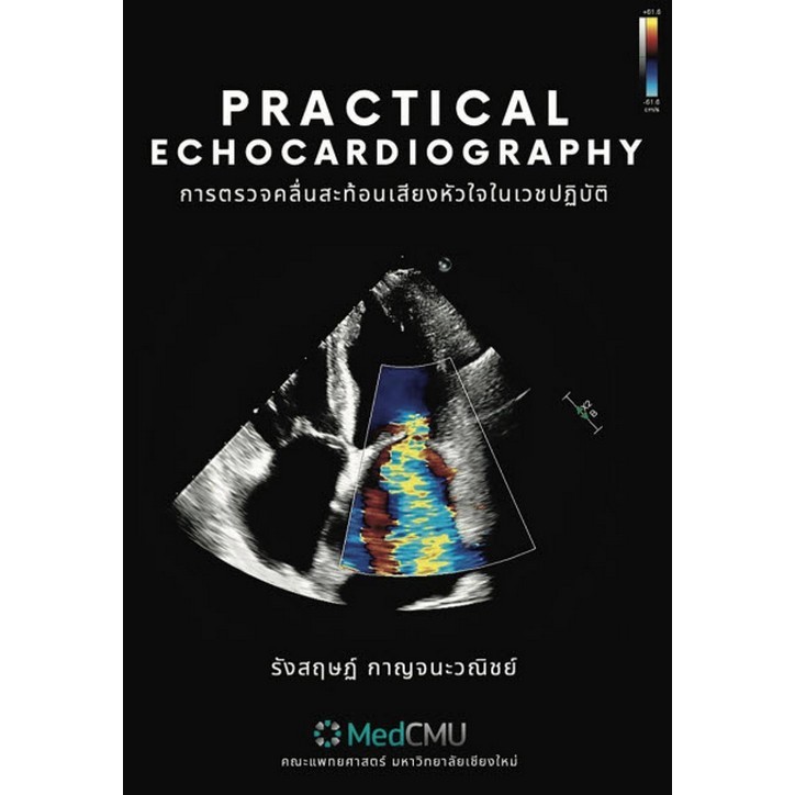 PRACTICAL ECHOCARDIOGRAPHY (การตรวจคลื่นสะท้อนเสียงหัวใจในเวชปฏิบัติ) - 9786166124675 | Shopee ...