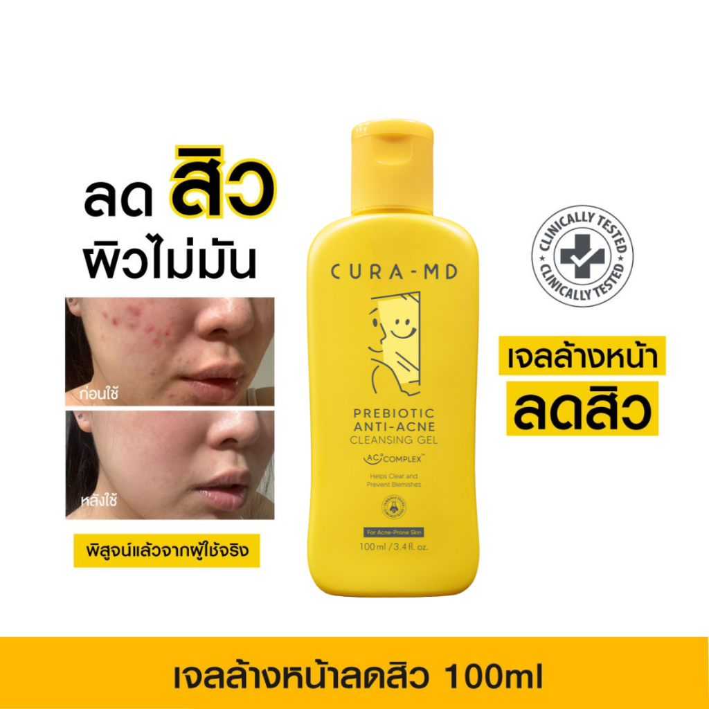 [ขายดี] CURA-MD เจลล้างหน้า สูตรลดสิว ลดผิวมัน กระชับรูขุมขน Prebiotic ...