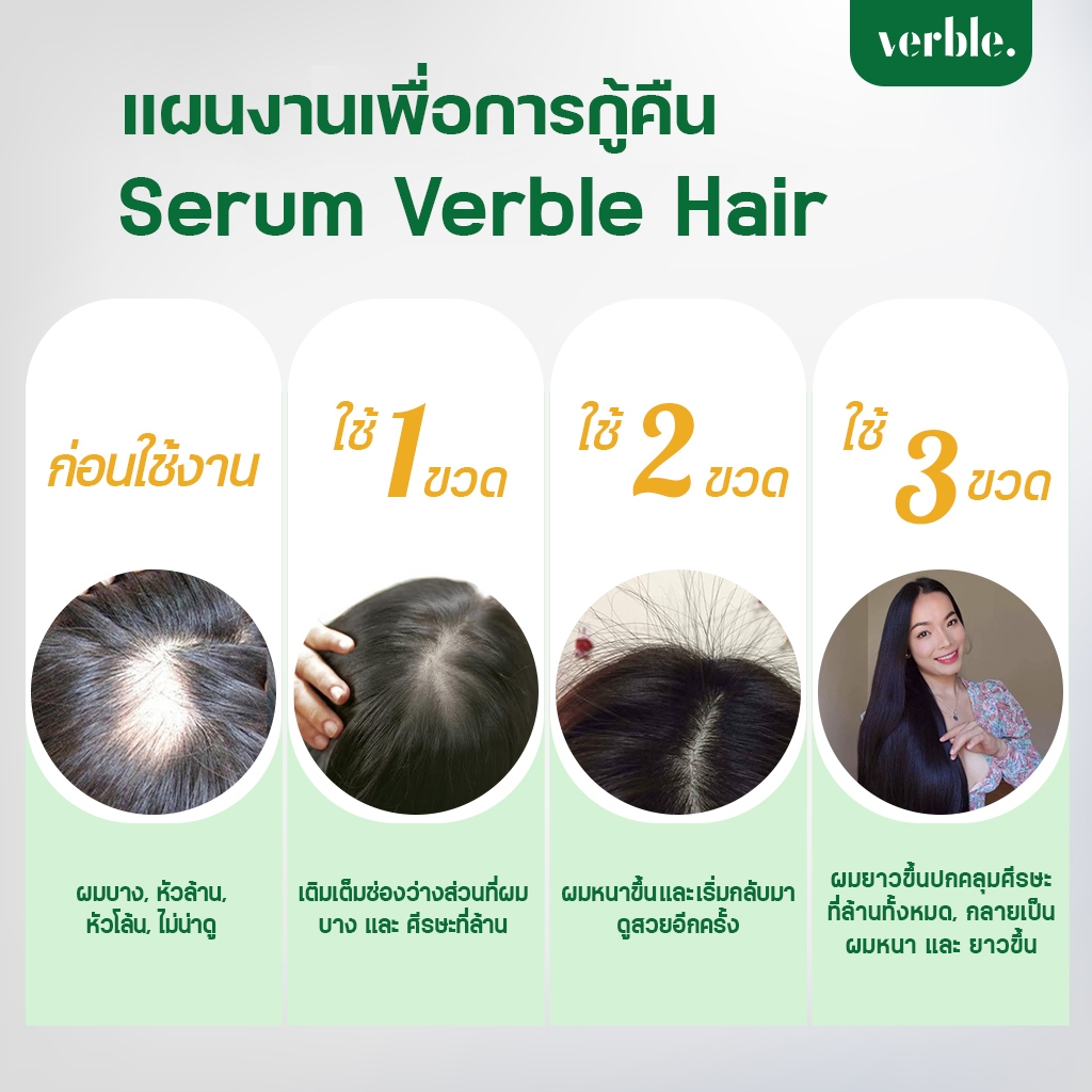 HAIR SERUM VERBLE เซรั่มปลูกผม - เซรั่มดูแลเส้นผมสุดเพอร์เฟค 35ML ...