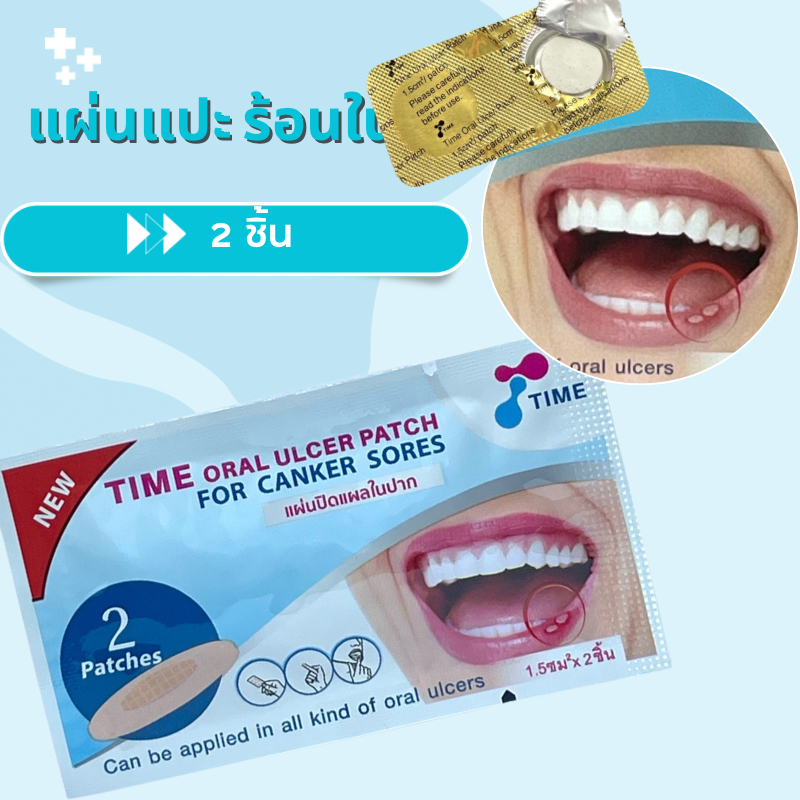 TIME Oral Ulcer Patch แผ่นแปะ แผลในปาก แผ่นปิดแผลในปาก แผลร้อนใน แผลกัด ...