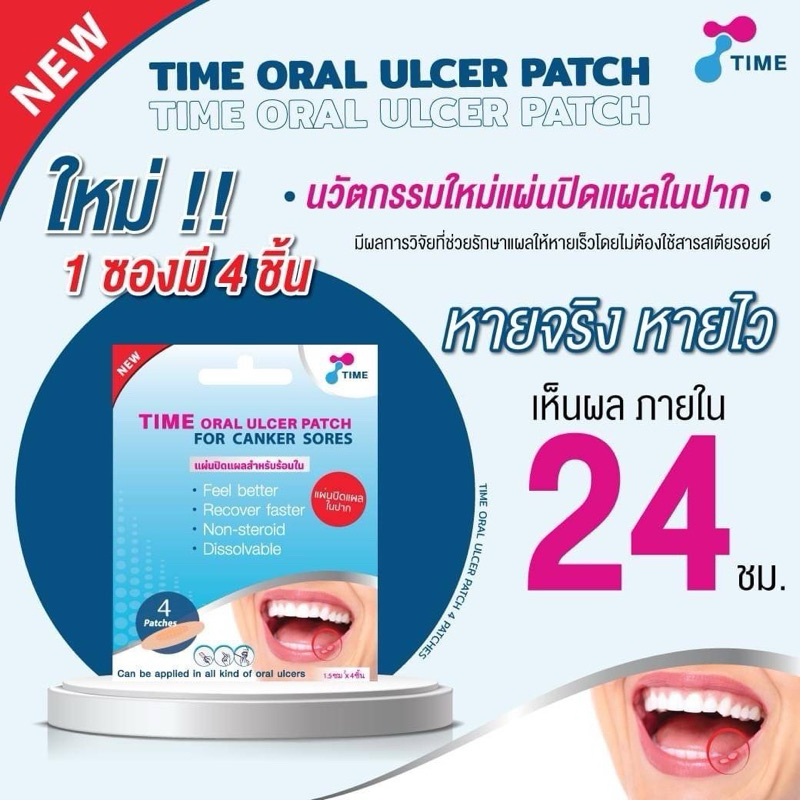 time oral ulcer patch ไทม์ แผ่นแปะแผลร้อนใน | Shopee Thailand