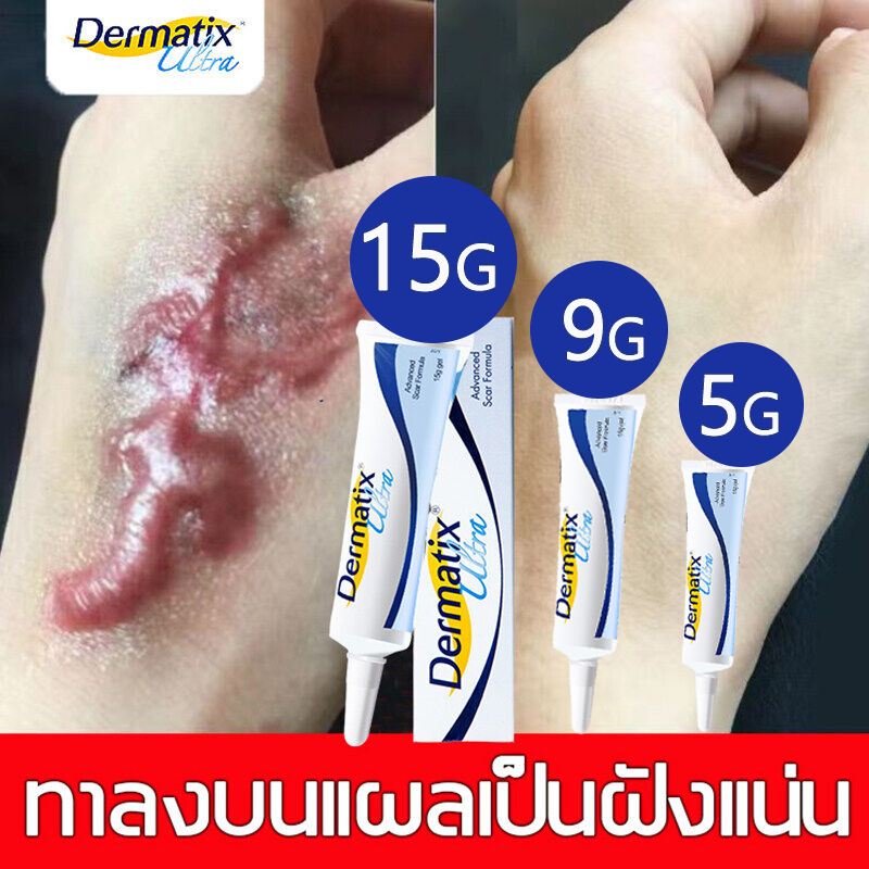 💥เจล:15g/9g/7g/5g💥ครีมทาแผลเป็น ครีมแผลเป็น เจลซ่อมแซม เจลรอยแผลเป็น รอยแผลเป็น รอยแผลเป็น แผล ...