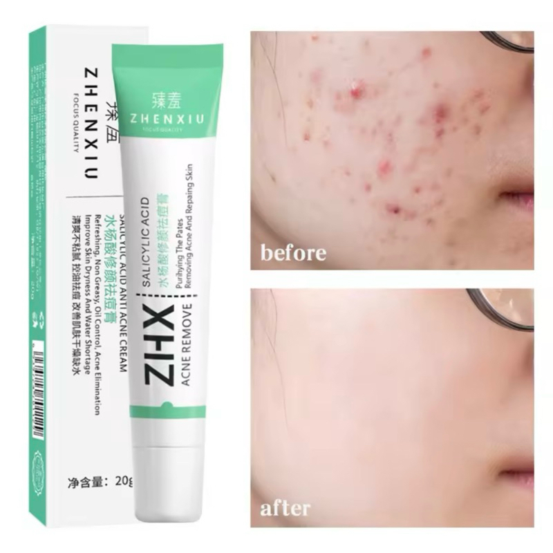 [🕸️พร้อมส่ง] ครีมบำรุงผิว ดูแลสิว ZHENXIU SALICYLIC ACID ZHX Acne ...