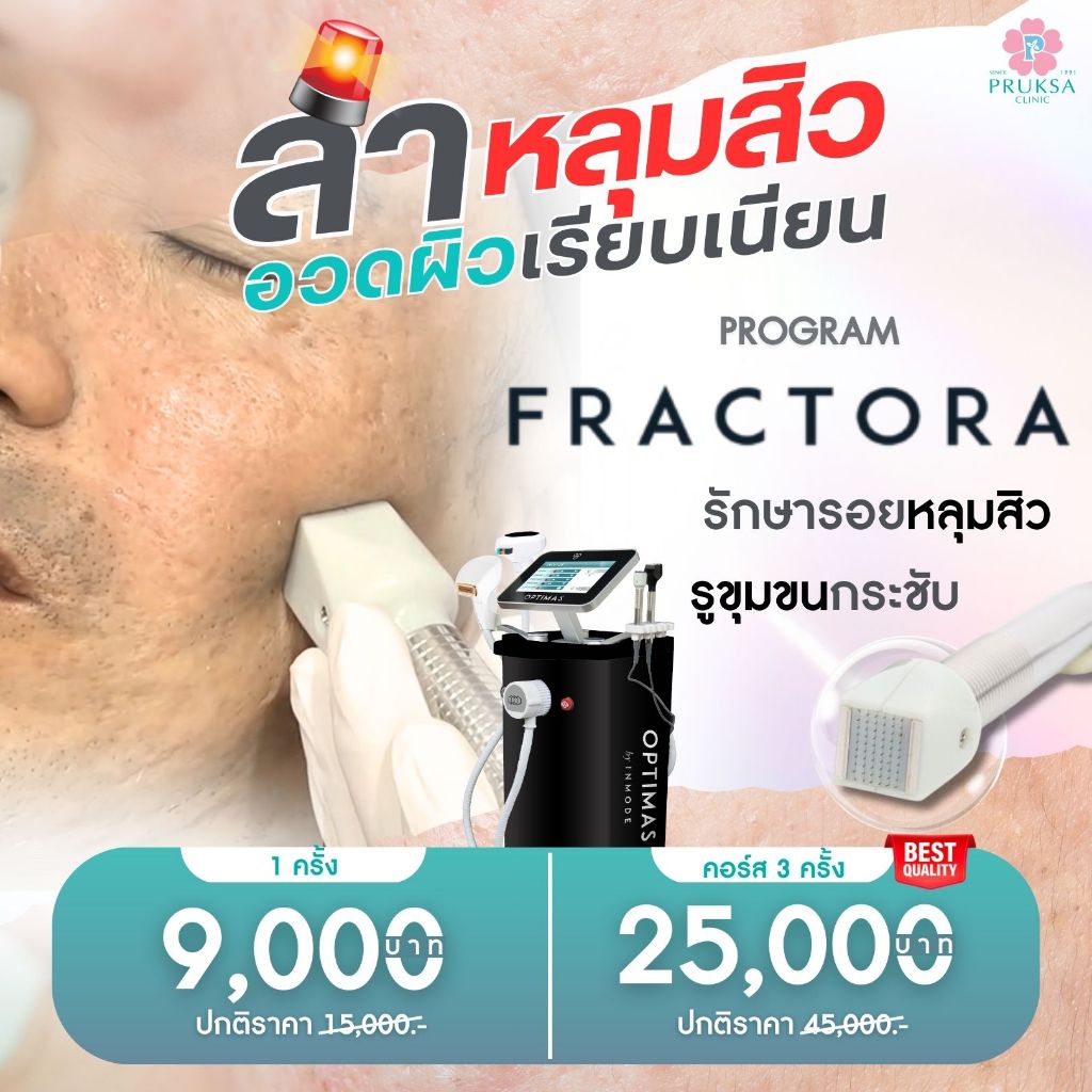 Pruksa Clinic โปรแกรม Fractora รักษาหลุมสิว รูขุมขนกระชับ เรียบเนียน | Shopee Thailand