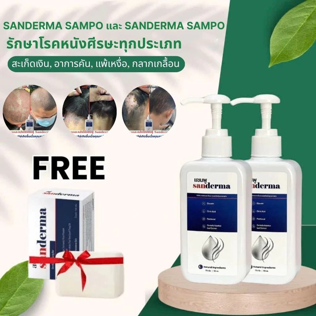 SANDERMA แชมพู แซนเดอร์มา พีเอช5 มายด์ แชมพู สำหรับผิวแพ้ง่าย ช่วยทำ ...