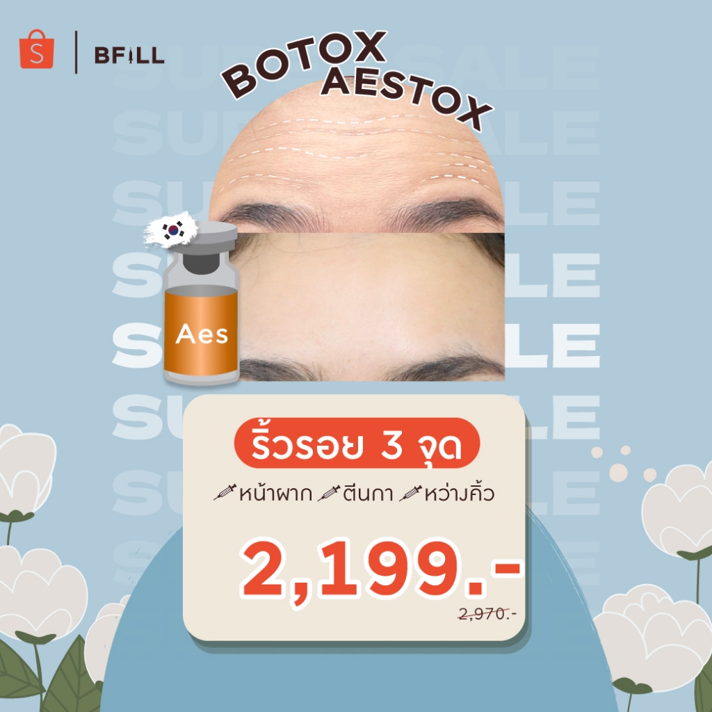 Botox (Aestox) Wrinkles โบท็อก ริ้วรอย ตีนกา หว่างคิ้ว ริ้วรอยหน้าผาก ...