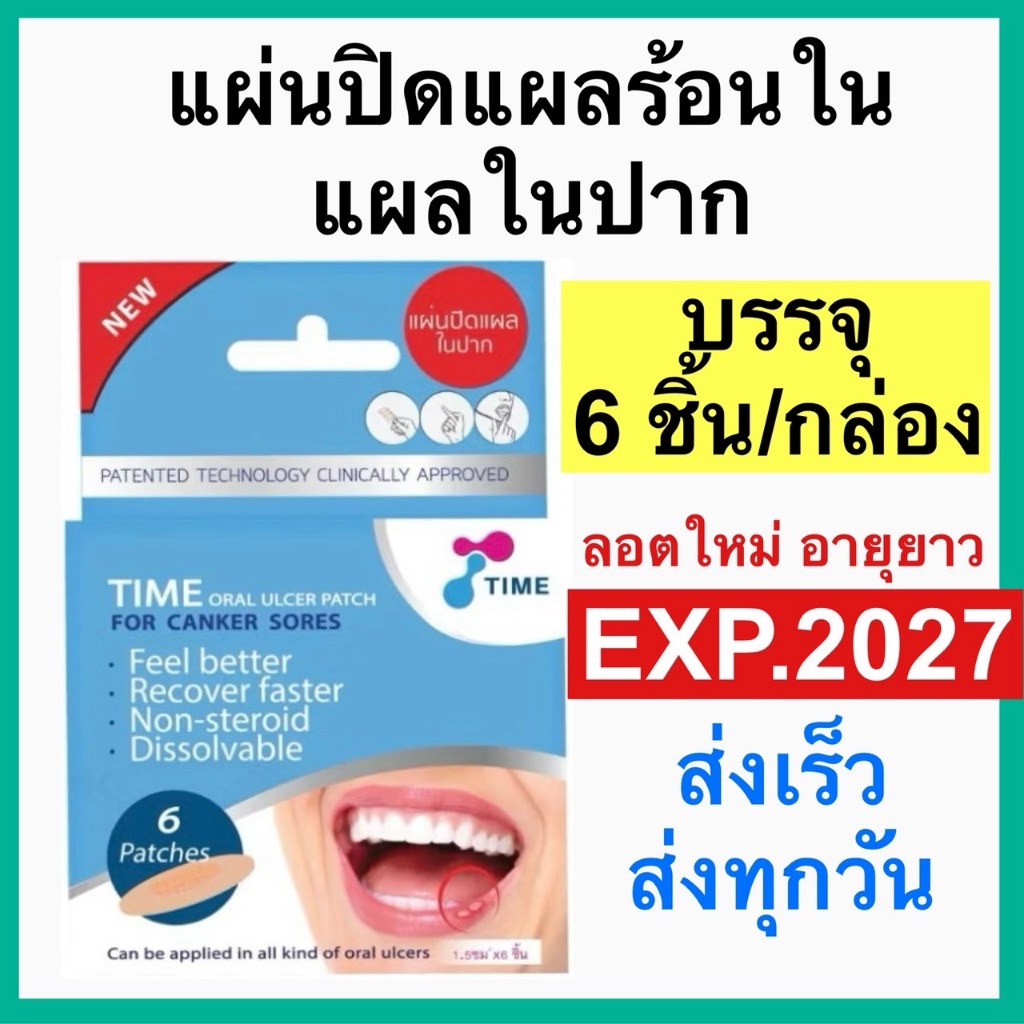 แผ่นแปะร้อนใน TIME Oral Ulcer Patch แผ่นปิดแผลในปาก แผลร้อนใน Canker ...