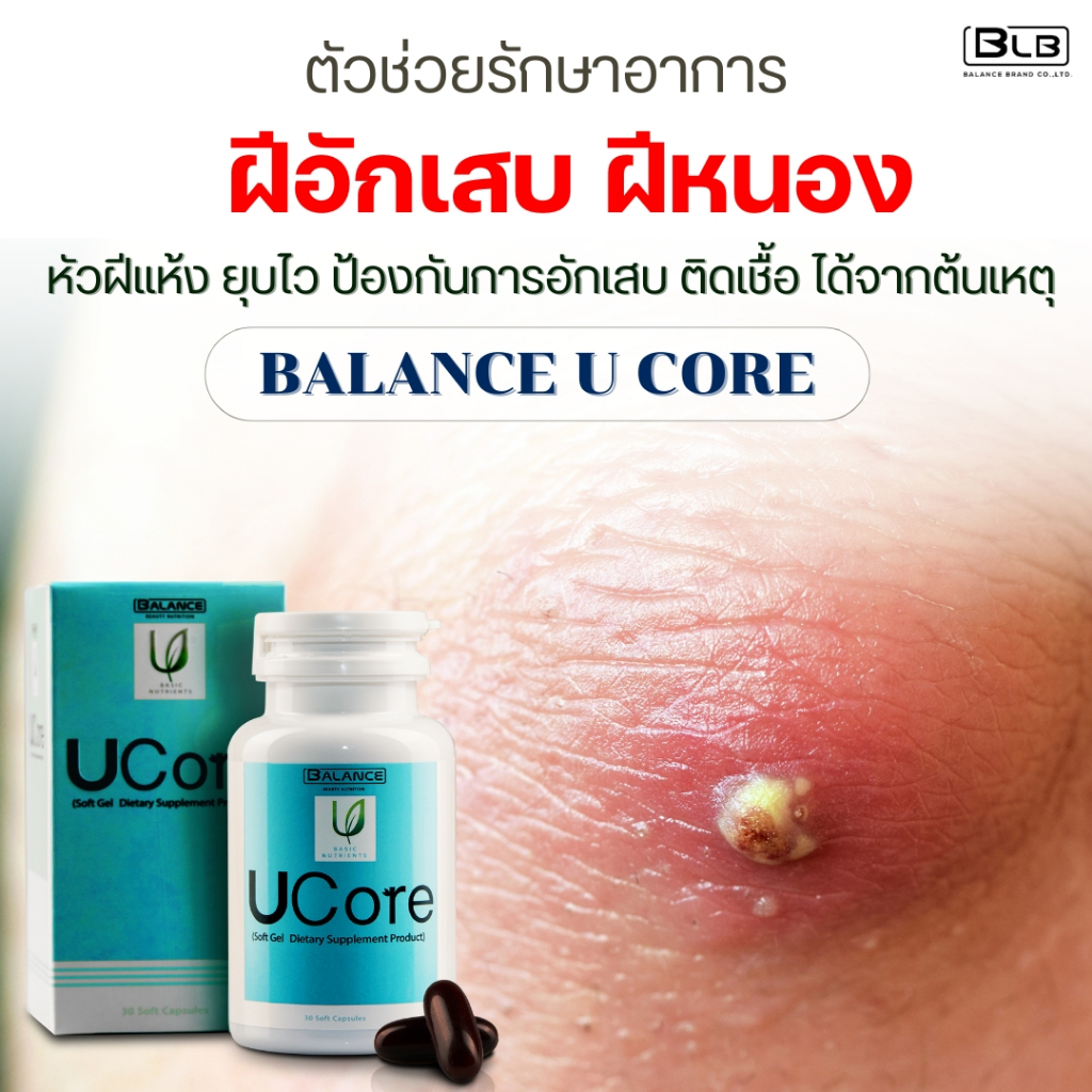 สมุนไพรฝีอักเสบ ฝีหนอง ดูแลด้วย Balance UCore | ของแท้ 100% ส่งจาก ...