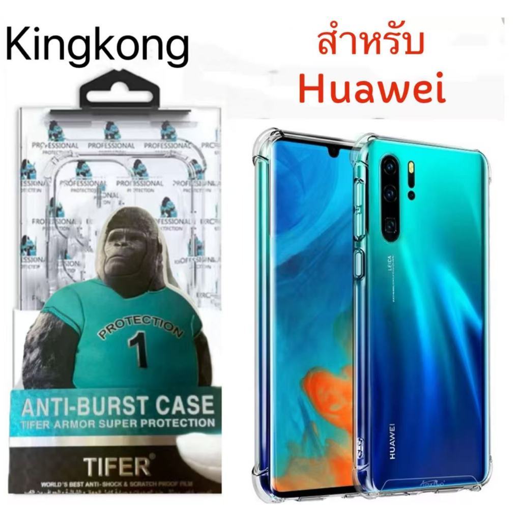เคสใสกันกระแทกคิงคอง Huawei P20 P20pro P30 P30pro P30lite P40 P40procase เคสกันกระแทก | Shopee ...
