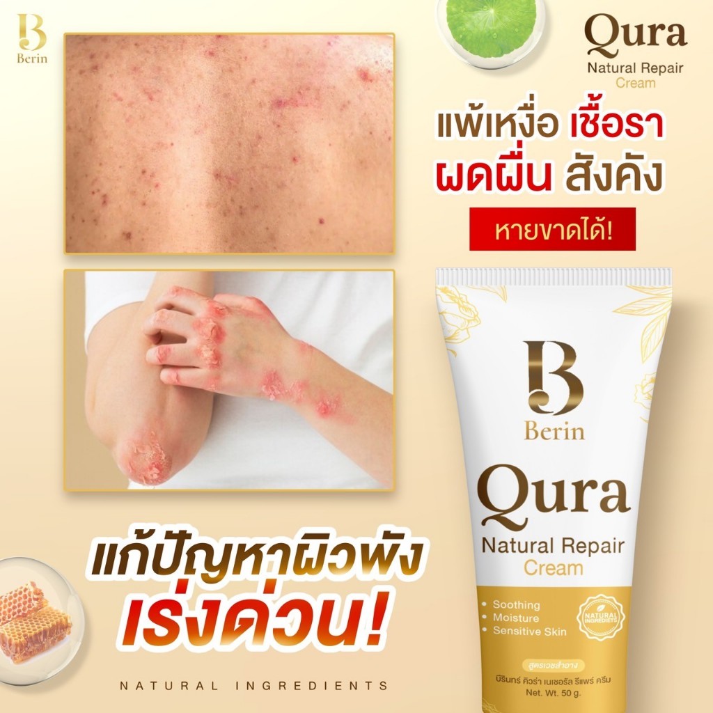 Qura cream ครีมคิวร่า สำหรับคนมีปัญหาผิวหนัง แบรนด์ Berin บีรินทร์ ผด ...