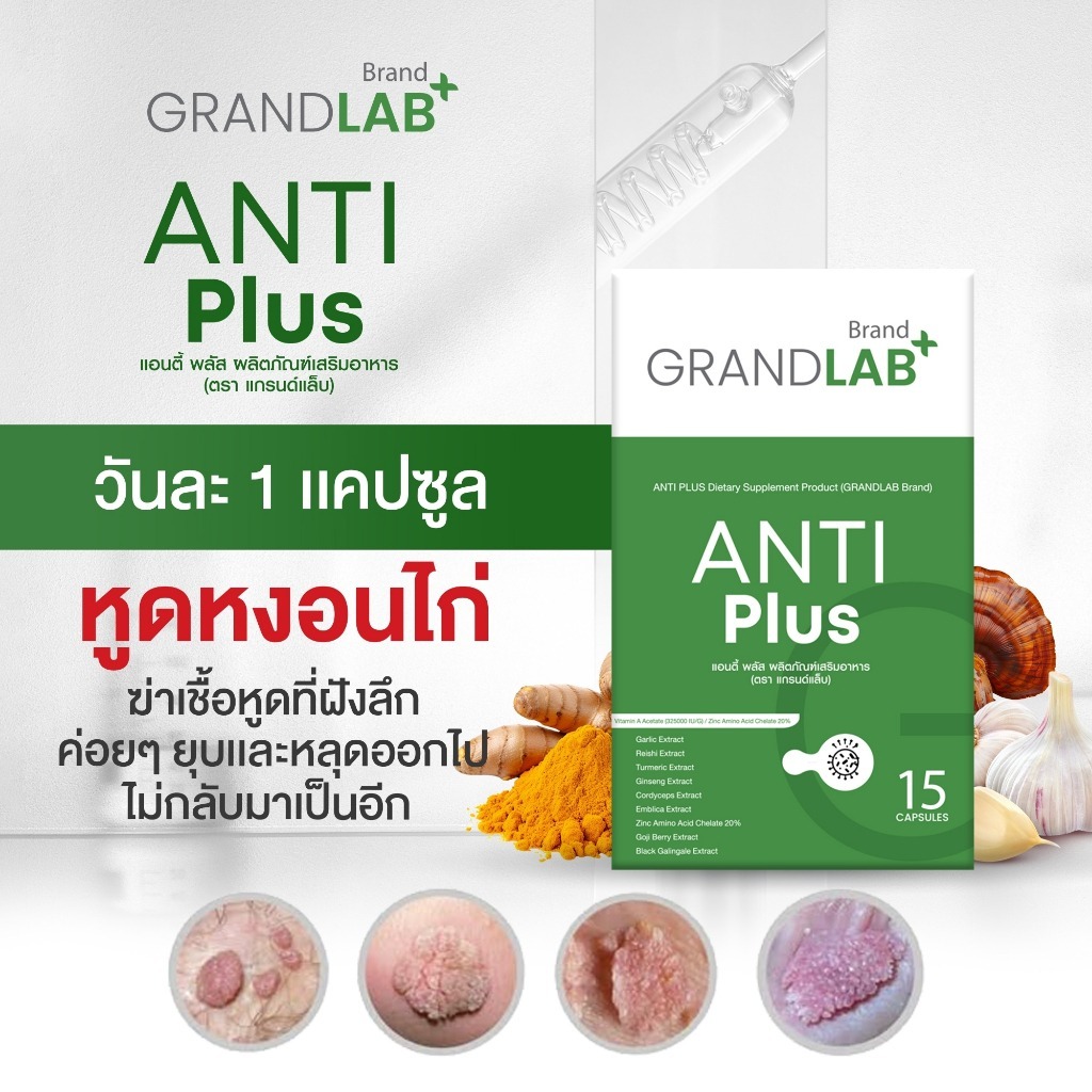 ผลิตภัณฑ์กำจัดหูดหงอนไก่ HPV ตุ่มในที่ลับ น้องชาย น้องสาว 15 แคปซูล ตราแกรนด์แล็บ | Shopee Thailand