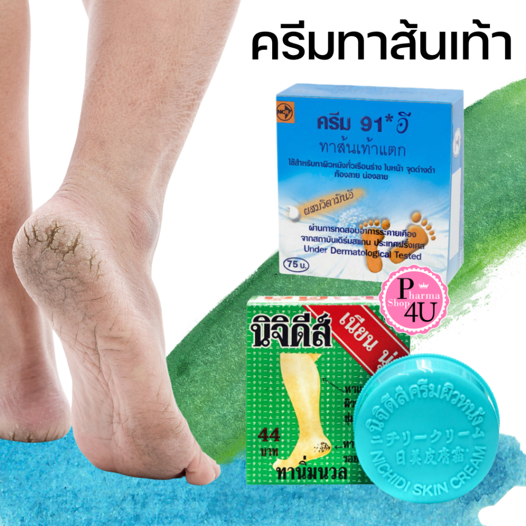 ครีมทาส้นเท้าแตก นิจิดีส์ ครีมทาผิวหนัง 15.3G / Cream 91E ทาส้นเท้าแตก ...