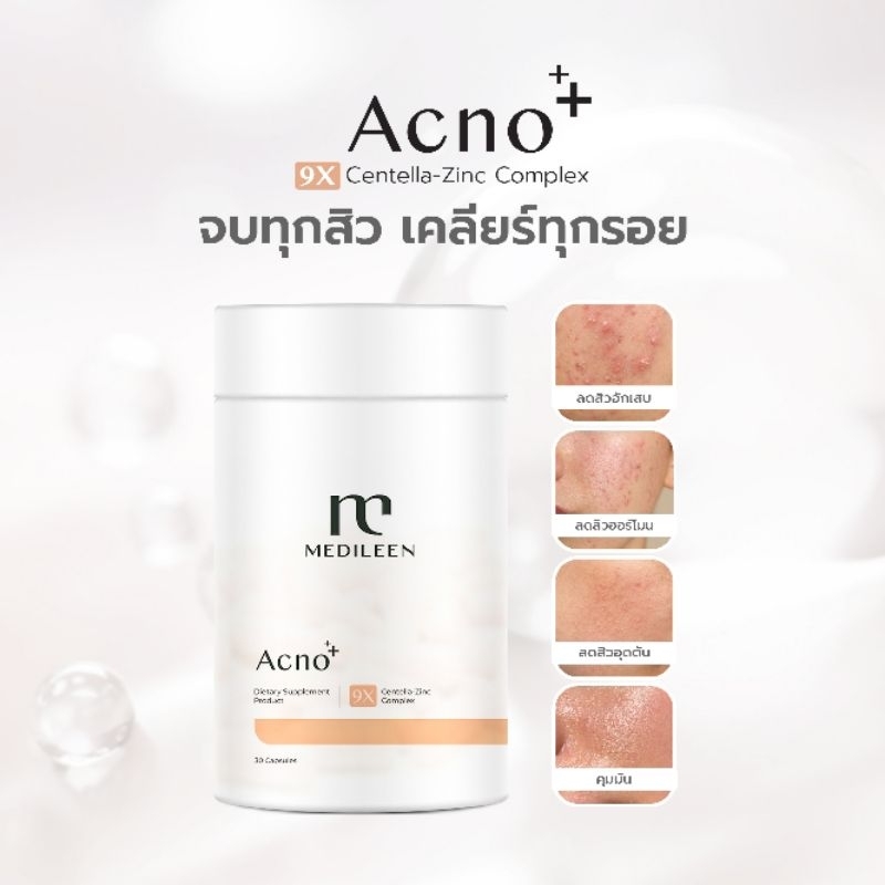 Acno+ วิตามินลดสิว คุมมัน สูตรหมอ มี 30แคปซูล | Shopee Thailand