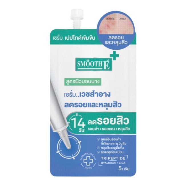 เซรั่มลดรอย สมูทอี SMOOTH E ACNE SCAR SERUM ( ซอง ) | Shopee Thailand