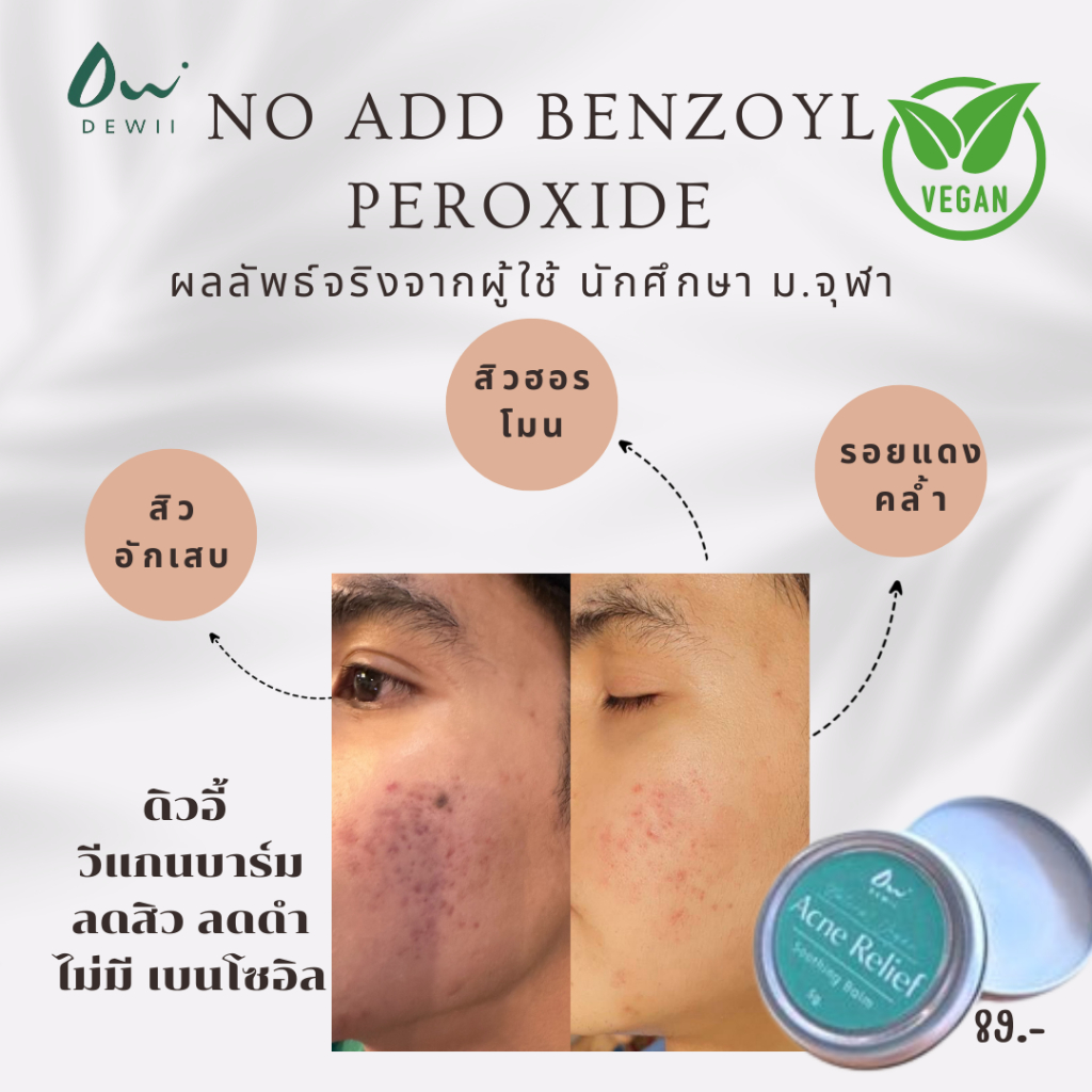 Dewii Natural Vegan Acne Relief Sooting | Shopee Thailand