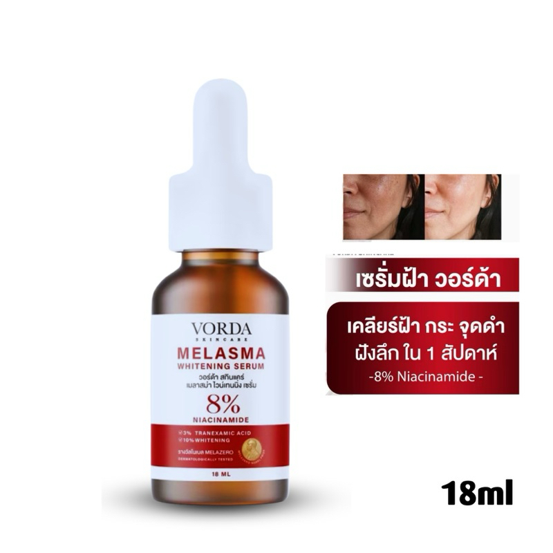 Vorda Skincare Melasma Whitening Serum วอร์ค้า สกินแคร์ เมลาสม่า ไวท์เทนนิ่ง เซรั่ม ผลิตภัณฑ์ ...