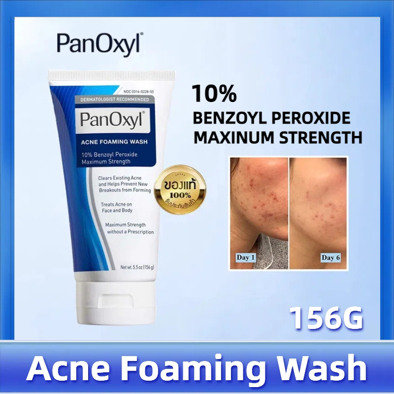 PanOxyl Acne Foaming Wash 10% Benzoyl Peroxide Maximum Strength 156g ...