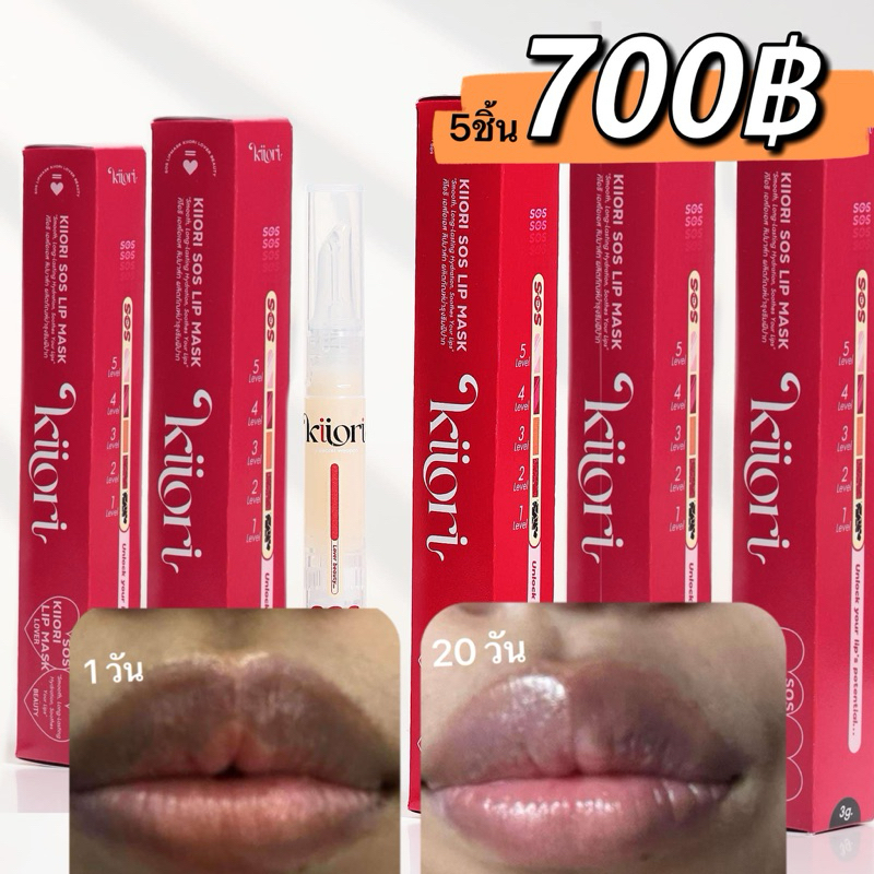 Kiiori SOS Lip Mask 5 แท่ง เพียง 700 บาท คุ้มสุด! คิโอริ เอสโอเอส ลิป ...