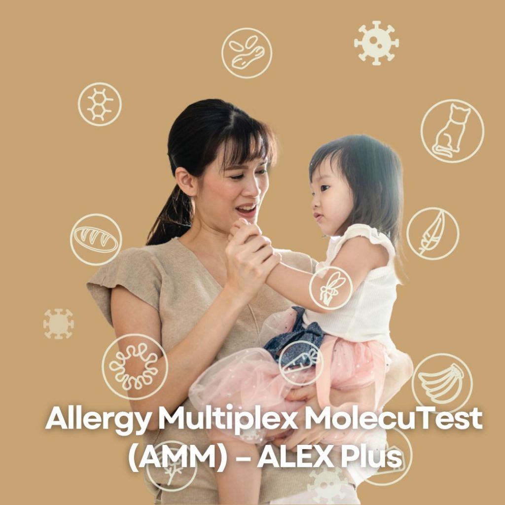[E-coupon] แพ็กเกจตรวจสารก่อภูมิแพ้ 295 ชนิด Allergy Multiplex ...