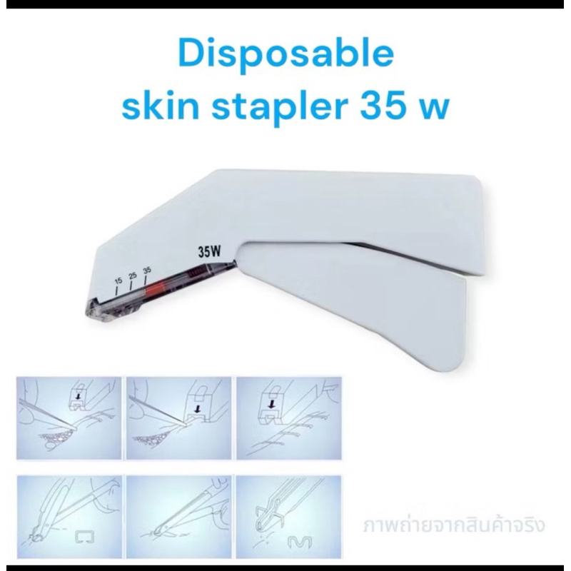 skin staple แม็กเย็บแผล สินค้าแพจเกจชำรุดต้องทำ ปราศจากเชื้อ ก่อนใช้งาน ...