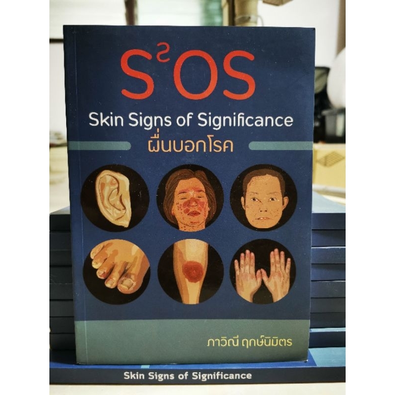 ผื่นบอกโรค Skin Signs of Significance / หนังสือ มือสอง สภาพ ดี | Shopee ...