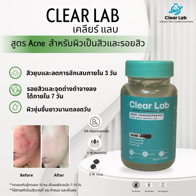 clear lab skin acne moist ampoule gel | Shopee Thailand