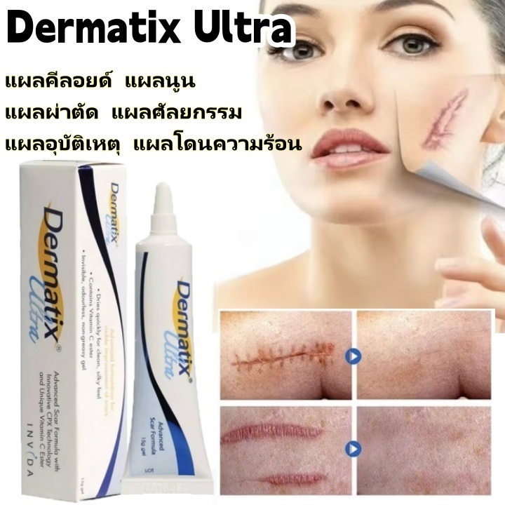 [ของแท้ 100%] Dermatix Ultra Gel Scar Ointment สามารถลดรอยแผลเป็น, รอย ...