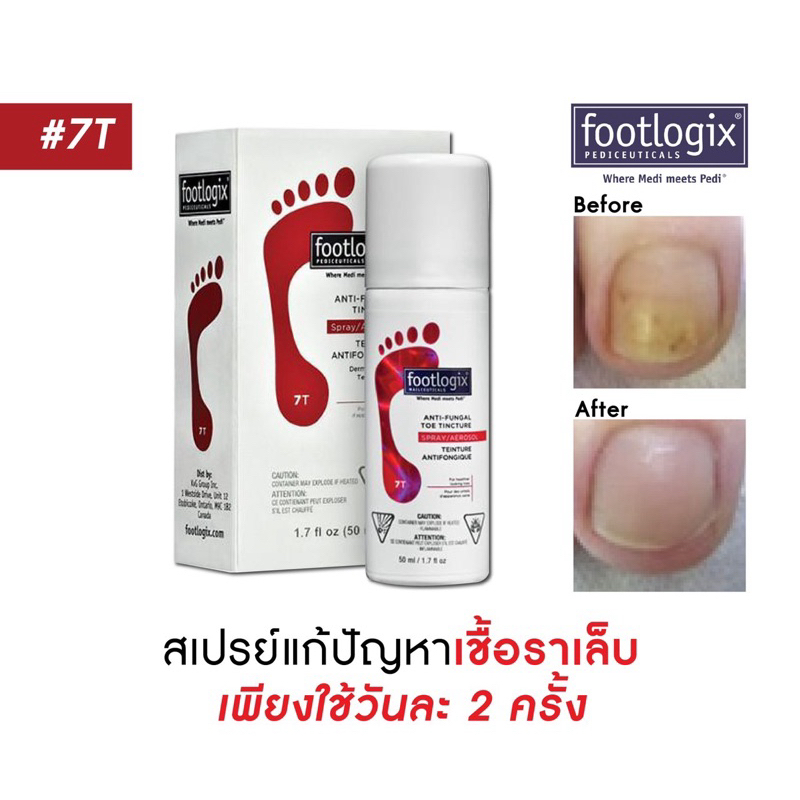 Footlogix Nail Tincture Spray 7T Anti fungal 50ml red ฟุตโลจิสต์ สเปรย์ ...