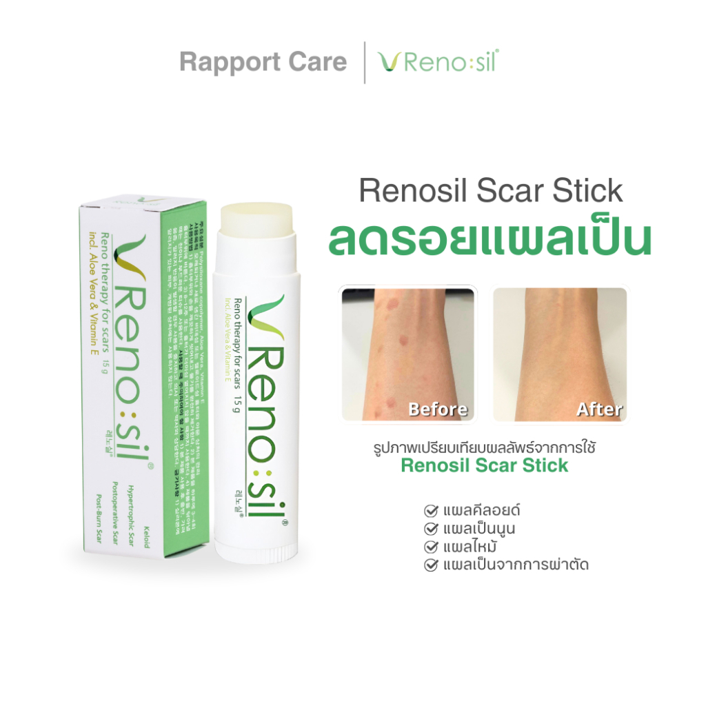 Reno:sil Scar Stick ผลิตภัณฑ์รักษารอยแผลเป็น | Shopee Thailand