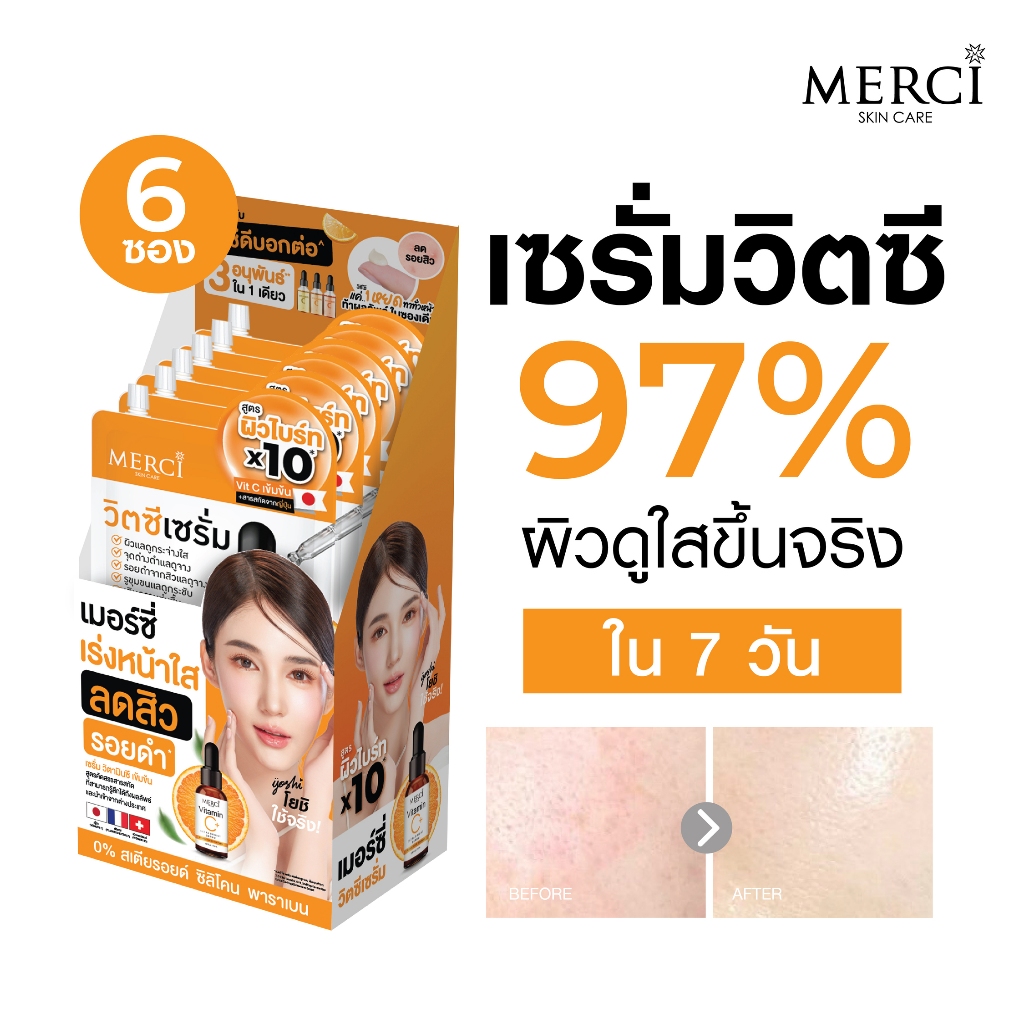 (1กล่องx6ซอง)Merci เซรั่มวิตซี เมอร์ซี่ แก้ปัญหาผิวหมองคล้ำ Merci ...