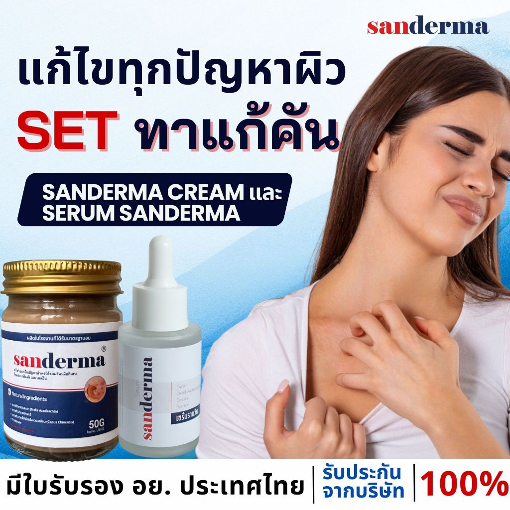 COMBO SANDERMA ทาแก้คัน ครีมแก้คัน ผื่นคัน เชื้อราที่ผิวหนัง กลาก ...