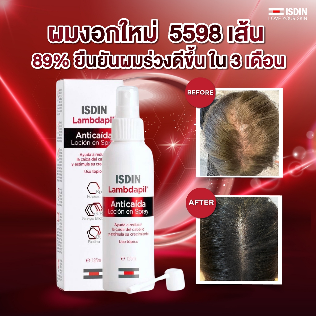 ISDIN LAMBDAPIL ANTI-HAIR LOSS LOTION SPRAY โลชั่นทรีทเม้นท์บำรุงผม ...