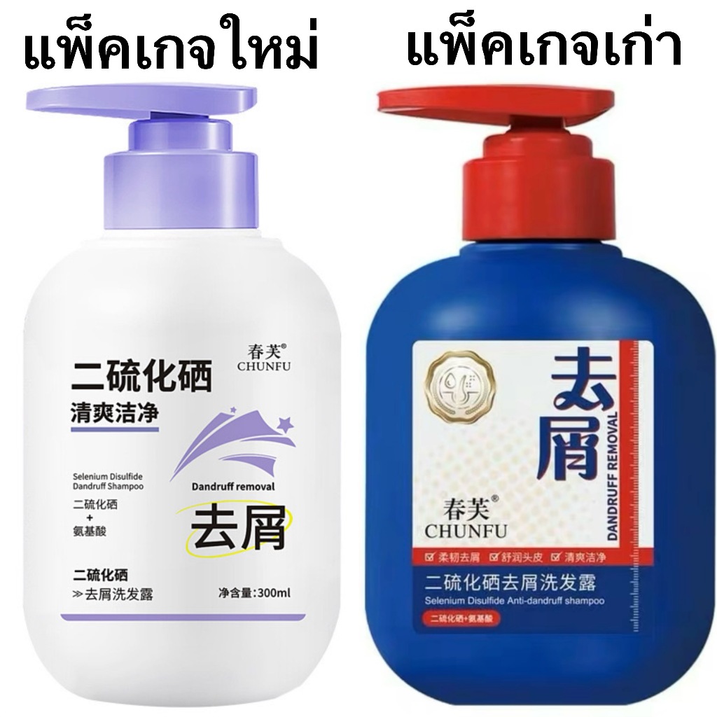 สินค้าส่งแพ็คเกจใหม่CHUNFU แชมพูขจัดรังแค ควบคุมความมันสำหรับผู้ชายและ ...