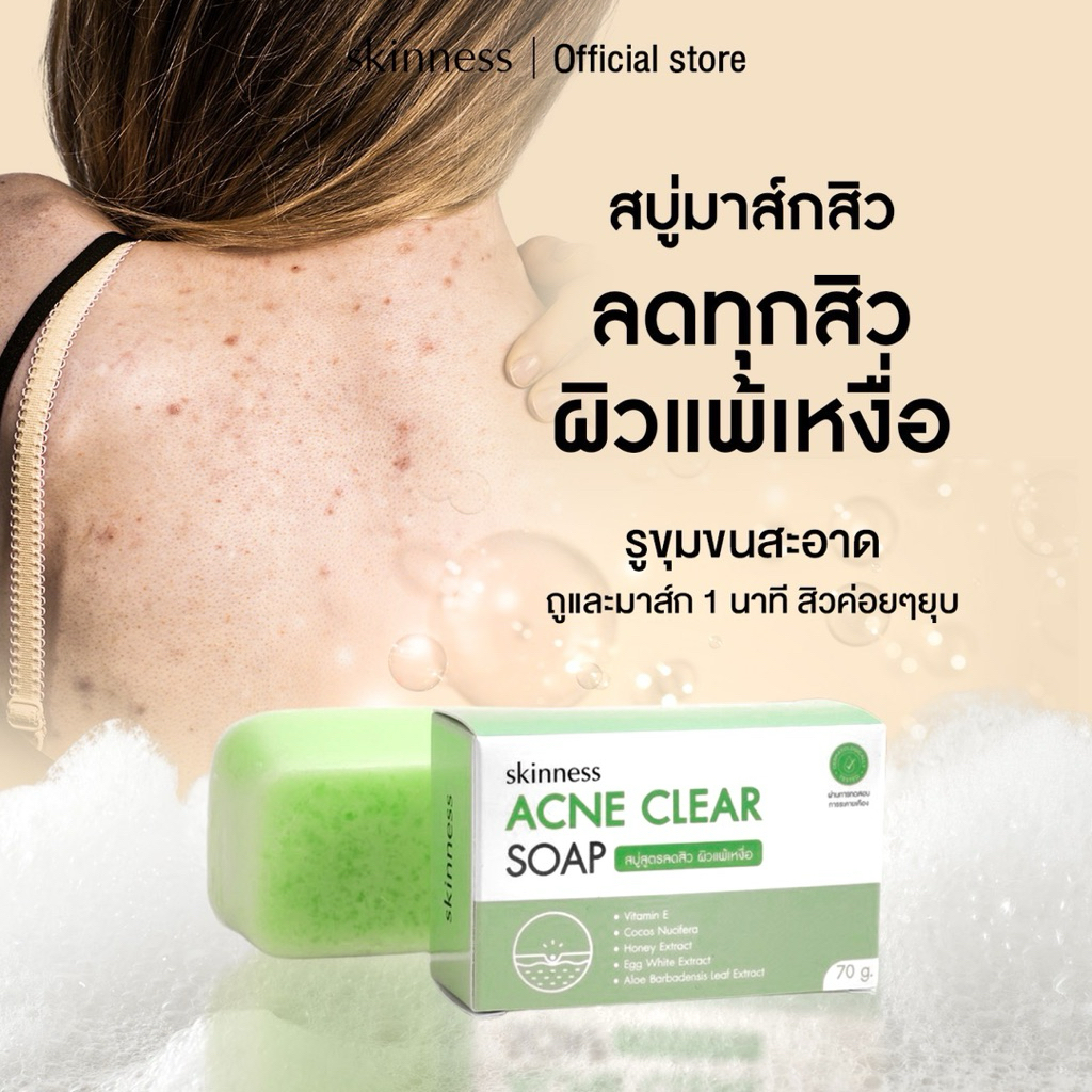 ใหม่! [พร้อมส่งทุกวัน] skinness acne clear soap | สบู่มาส์กสิวลดทุก ...