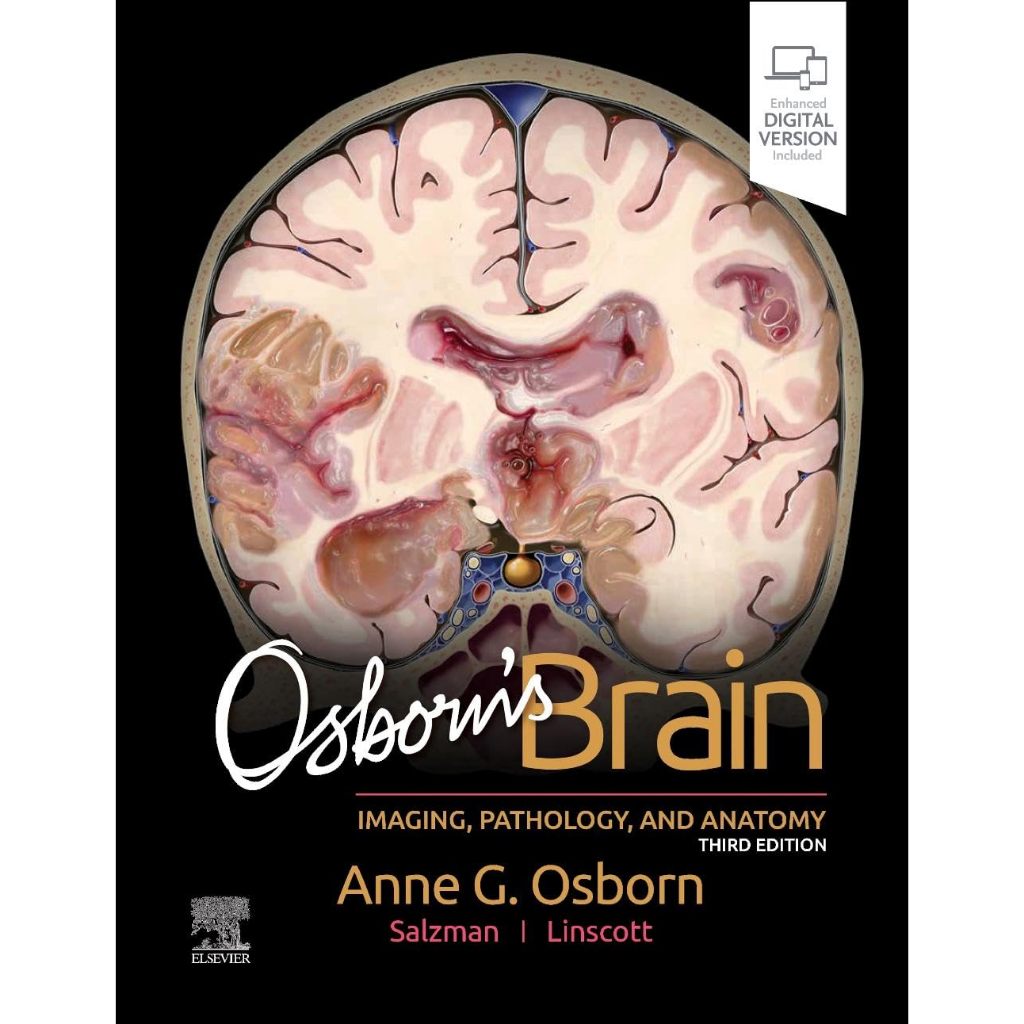หนังสือ Osborn's Brain:Imaging, Pathology, and Anatomy Ed.3/2024 ...