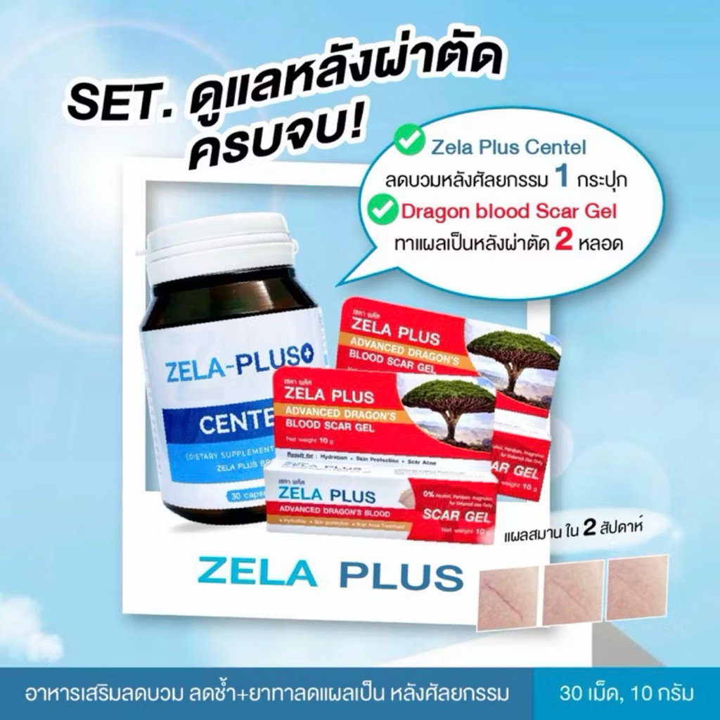 ชุดอาหารเสริมลดบวม/ครีมลดการอักเสบ หลังศัลยกรรม Zela PLUS +Centel [ทาน ...