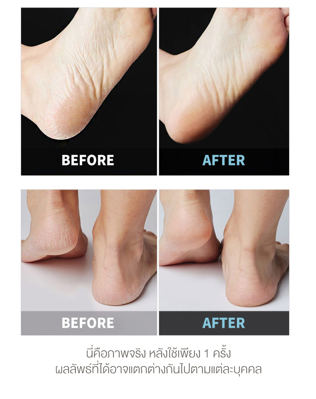 [PLU DUO SET] PLU INTENSIVE REPAIR FOOT CREAM 100ML + PLU PERFECT FOOT ...