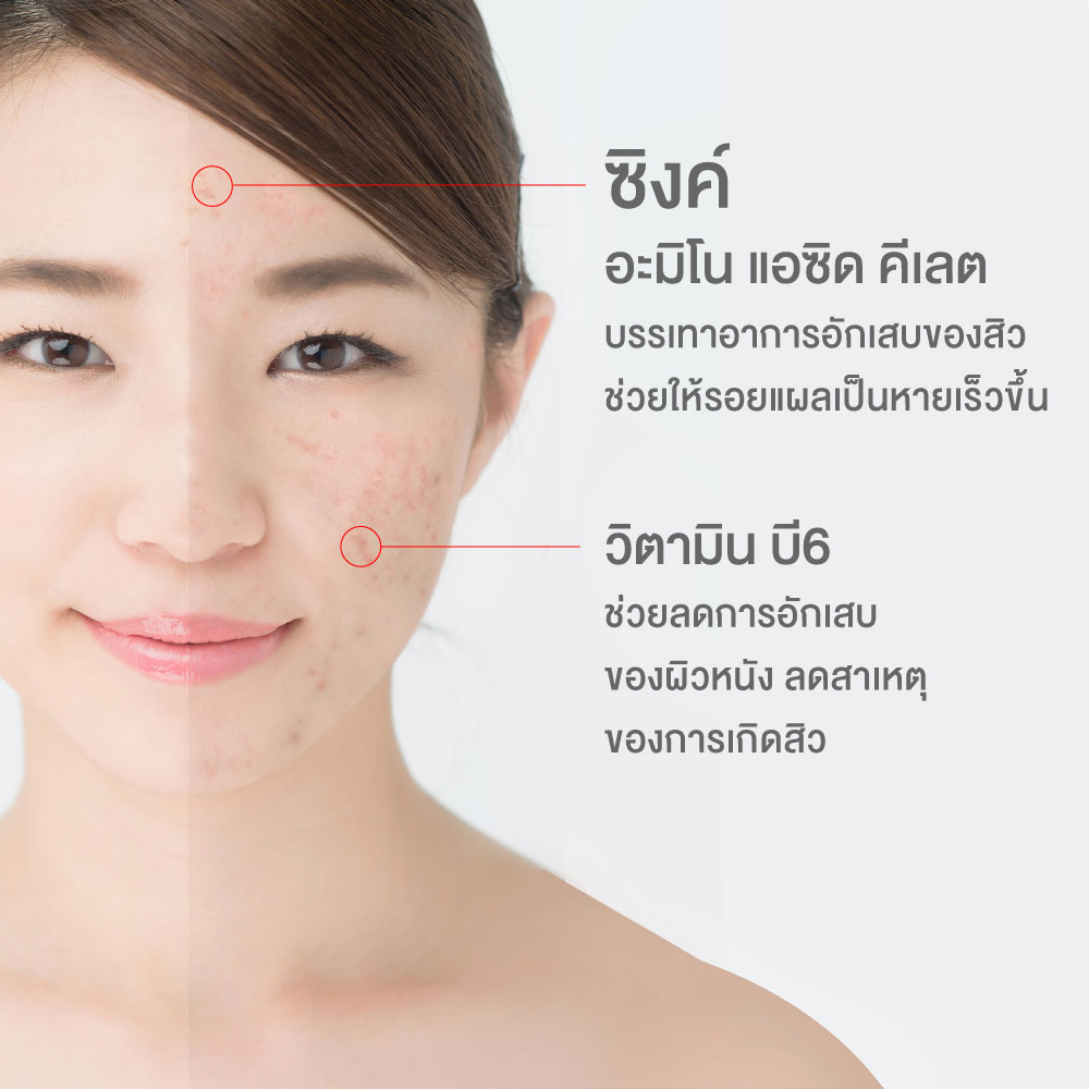 InterCare Zinc plus มัลติวิตามิน สกัดจาก ซิงค์ 75 mg และวิตามินรวม 8 ชนิด (1 กระปุก 30 เม็ด ...