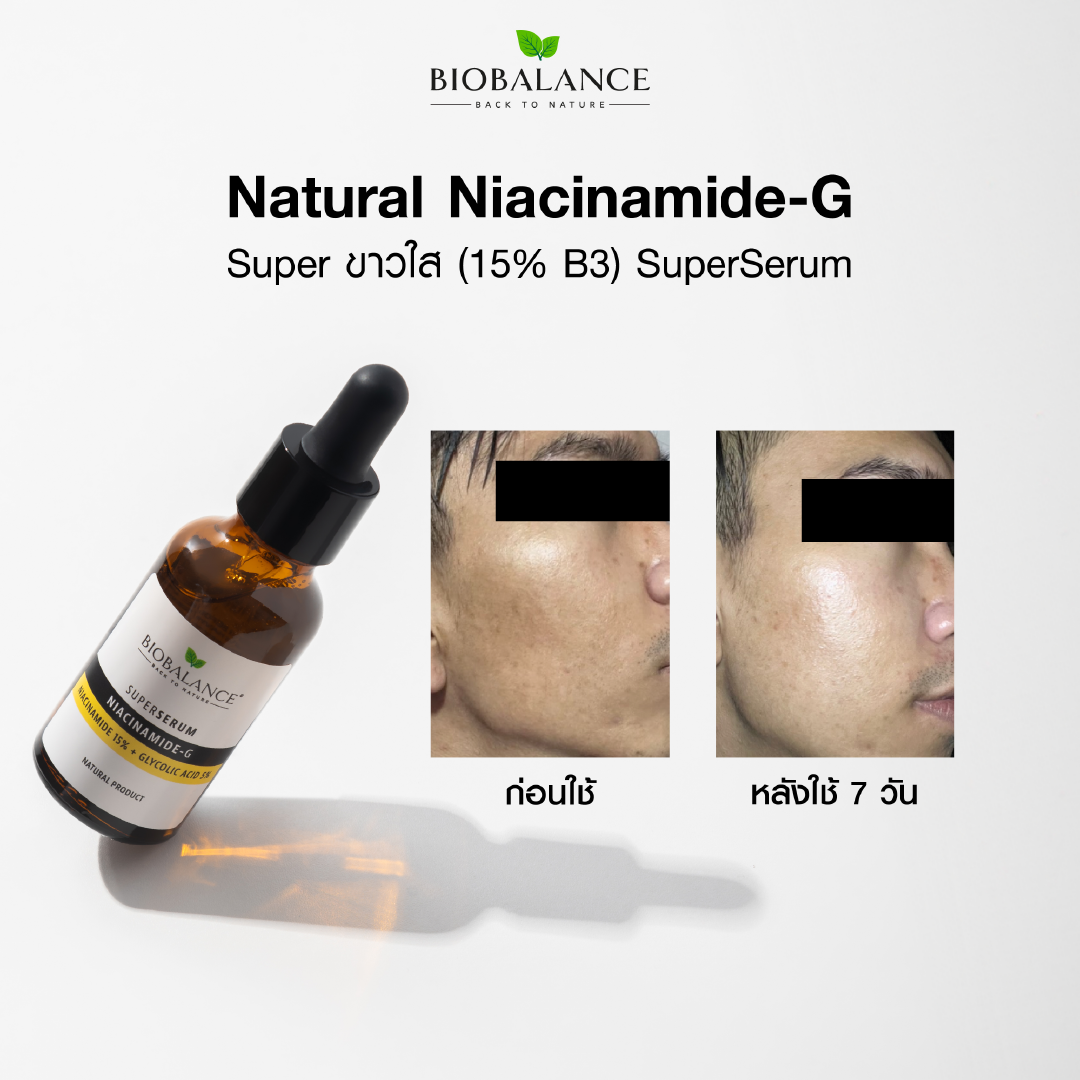 BIOBALANCE NIACINAMIDE-G SUPER SERUM 30 ML | Shopee Thailand