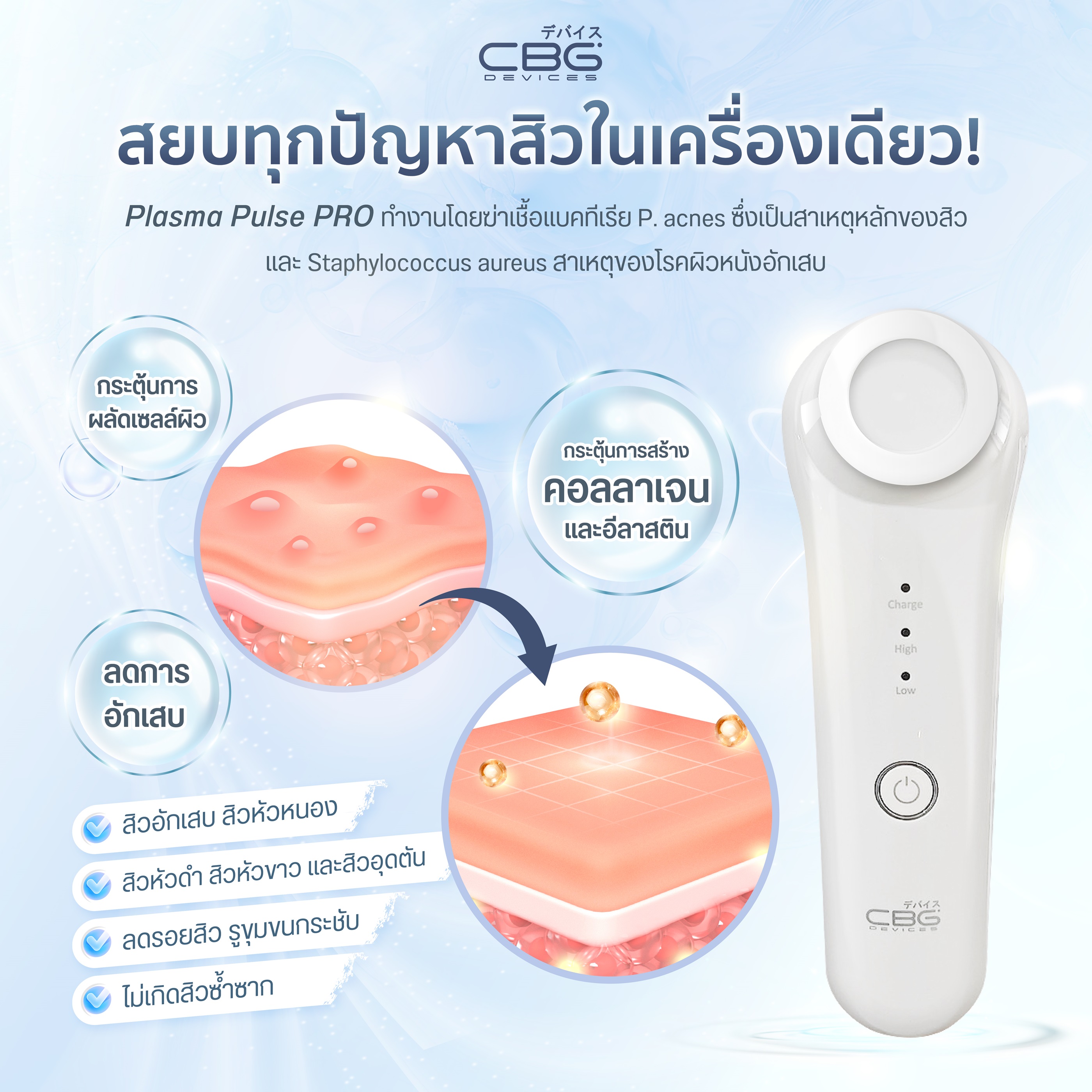 CBG Devices Plasma Pulse PROเครื่องฆ่าเชื้อสิวแบบตรงจุด ด้วยPlasma ...