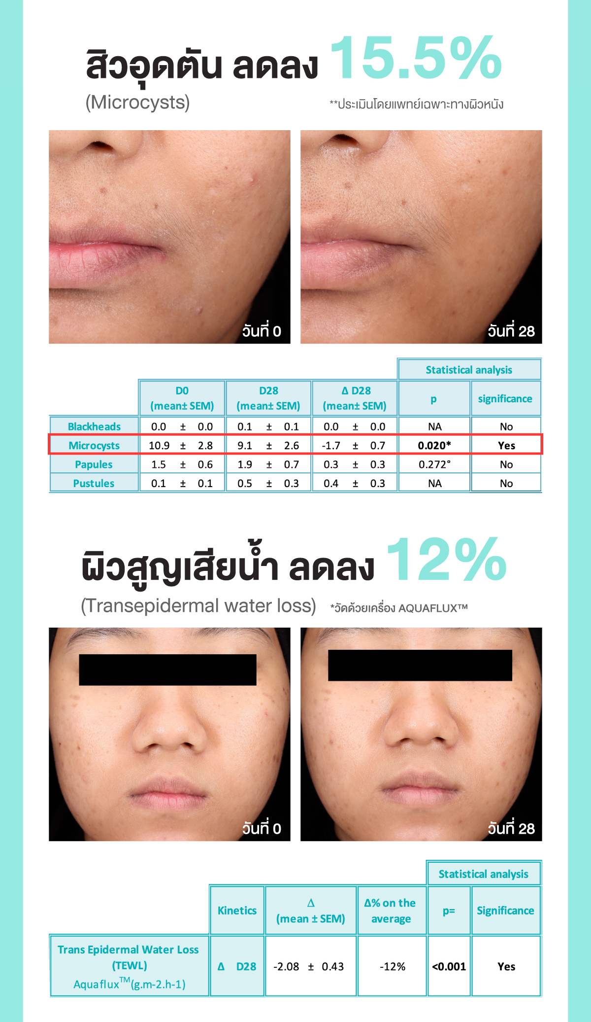 Dr.PONG 123 Instant Clear Skin Makeup Remover คลีนซิ่งลดสิว ล้าง PM2.5 มีงานวิจัย Micellar ...