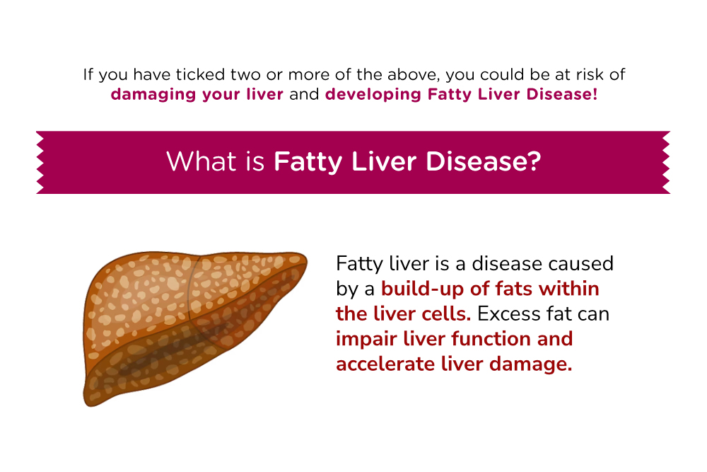 LAC ACTIVATED - Liver Protector Liver Detox Fatty Liver 80 Vegicaps ...
