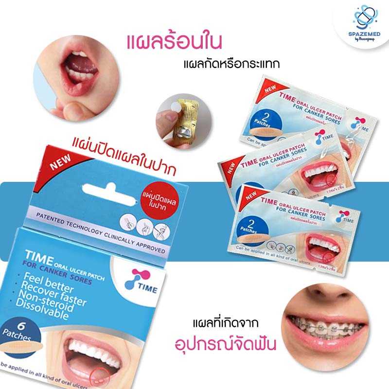 แผ่นแปะแผลร้อนใน TIME ORAL ULCER PATCH 6 ชิ้น แผลในปาก แบบกล่อง ...